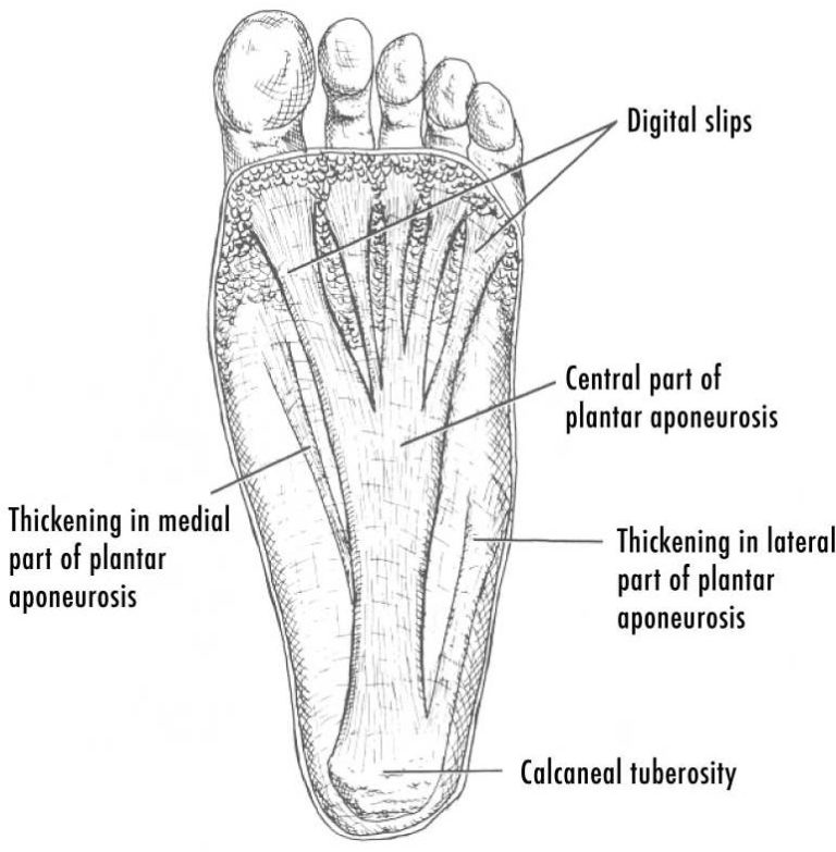 Plantar Fasciitis Foot Pain in Clearwater, FL | Dr. Russell Janssen